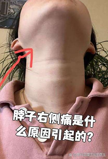 颈椎右侧痛要当心了图标