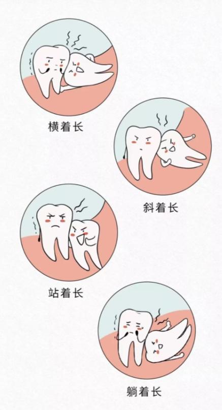 智齿松动了需要拔掉吗