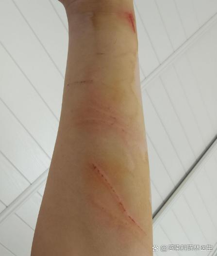 猫抓截图
