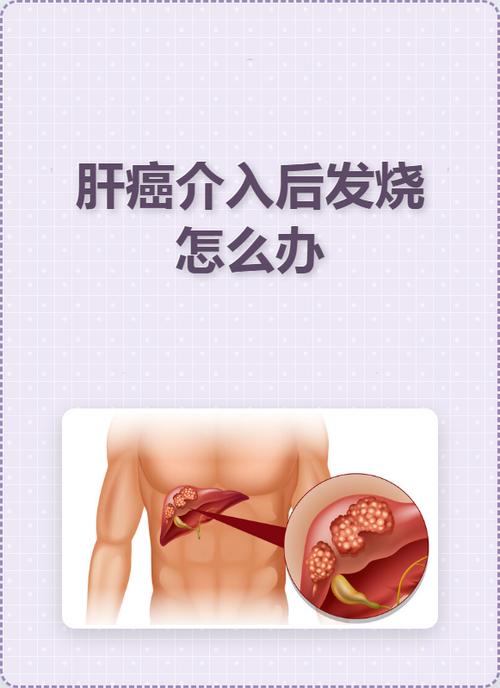 介入后发烧是好还是坏图标