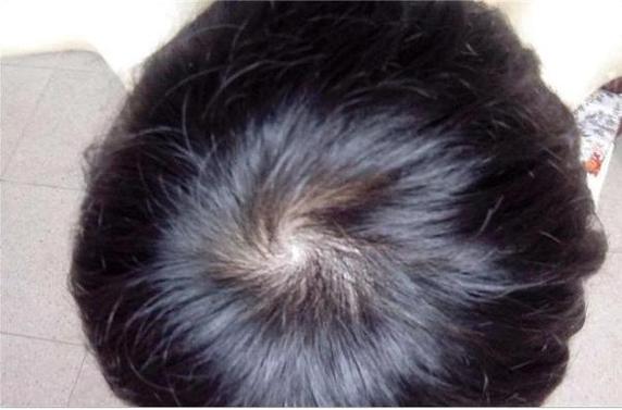 两个漩涡的女孩命好不好图标
