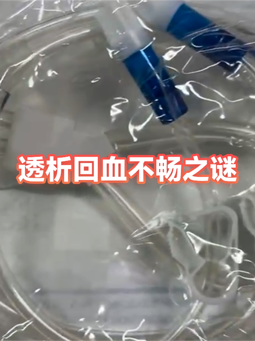回血受阻截图