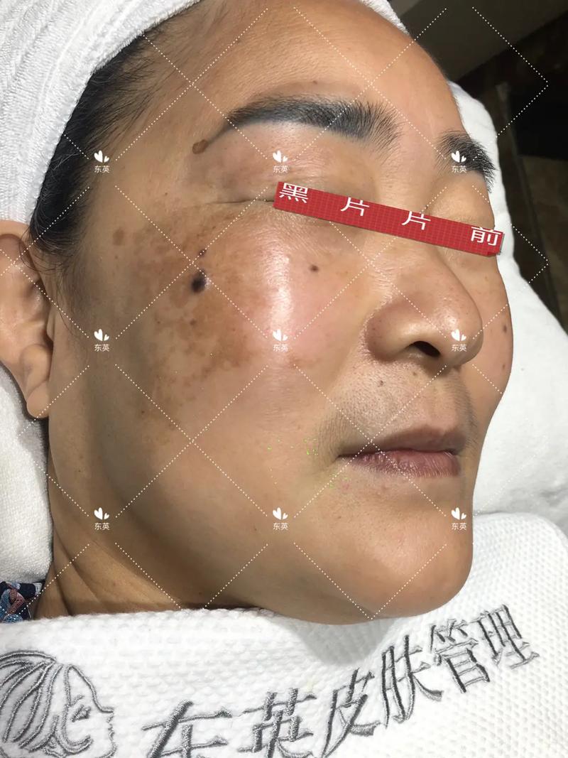 苹果屏幕黑点能修复吗图标