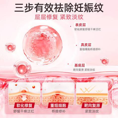 擦什么可以淡化妊娠纹图标