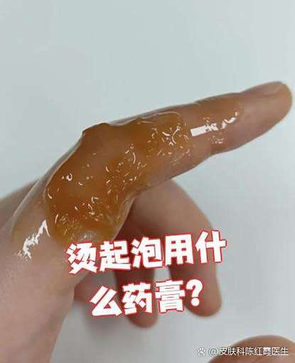 烫伤拿什么擦好最快图标