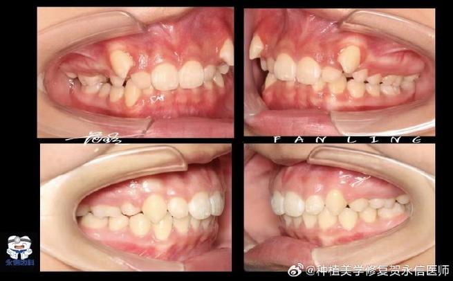 小虎牙百度云图标