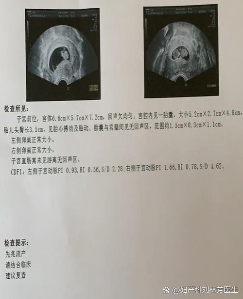 找不到孕囊只有暗区图标