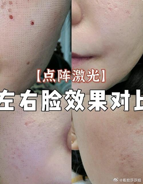 点阵激光视频在线观看图标