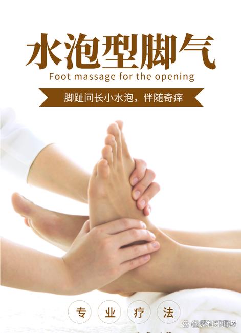 脚特别痒怎么办小妙招图标
