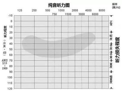 声音加速音调不变图标