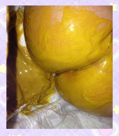 肚子咕噜叫放屁又拉稀截图