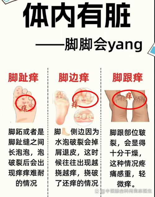 足癣图片截图