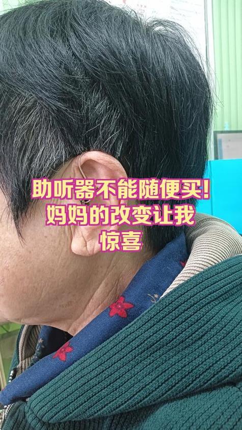 助听器可以随便买吗图标