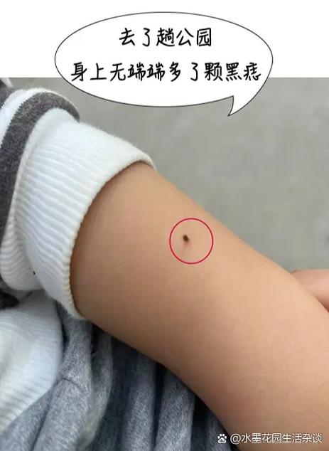 植物人临终前7天征兆