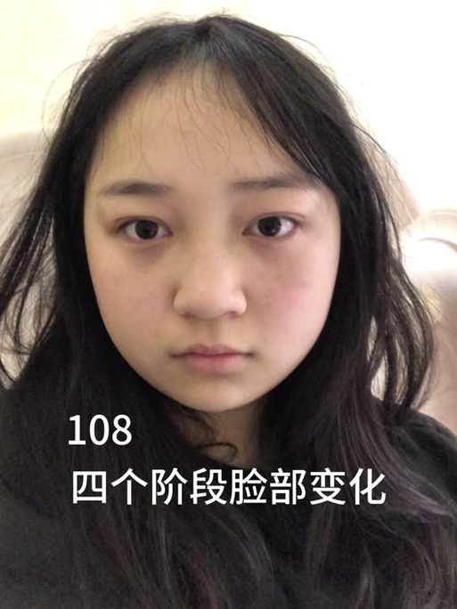 瘦20斤脸部对比