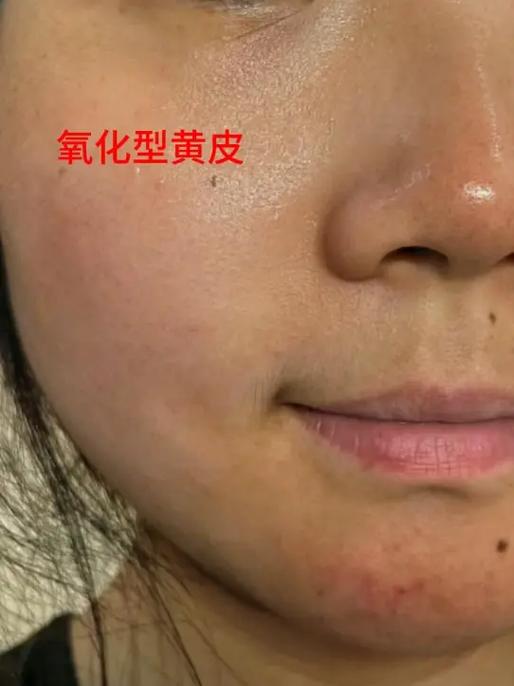 脸色为什么发黄图标
