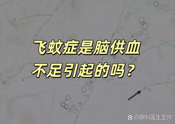飞蚊症是脑供血不足引起的吗图标