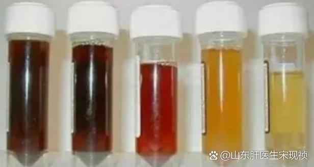 红黄尿是怎么回事图标