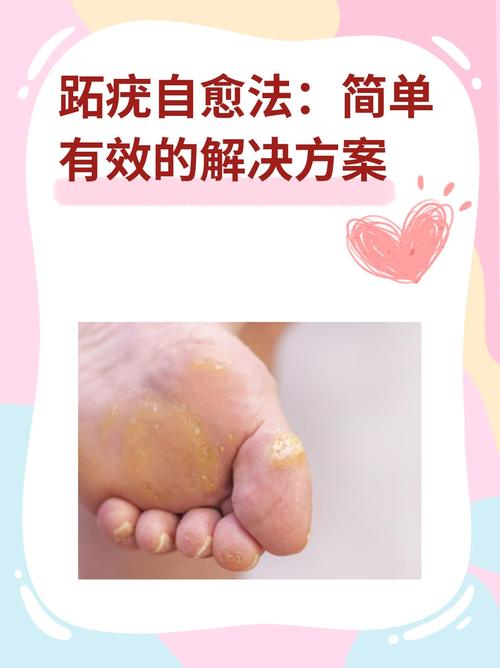 跖疣专用药膏游戏截图