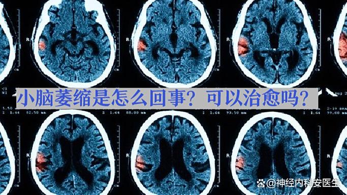 畏缩状态触发效果截图
