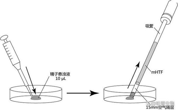 冷冻一管精子够用吗图标