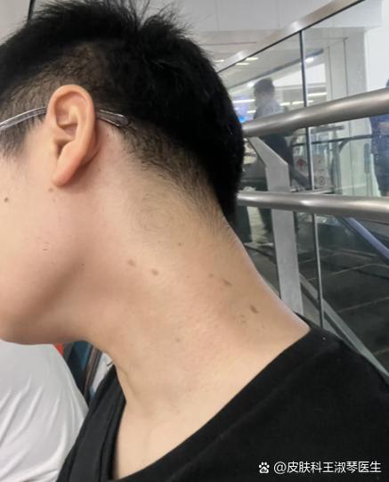 iphone小圆点白色变黑色图标