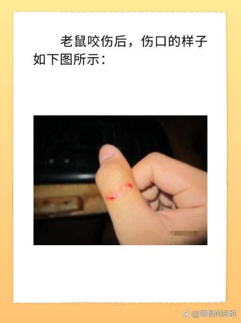 接触过老鼠咬过的东西会怎么样图标