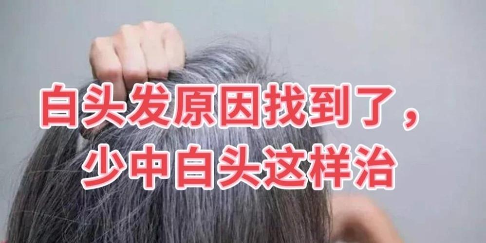 白发真的能治好吗截图