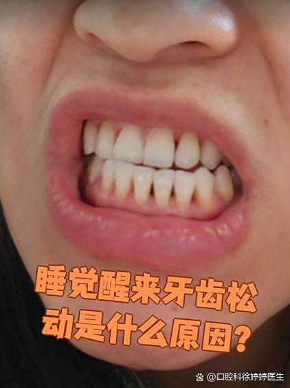 做梦牙齿松动但是没掉图标