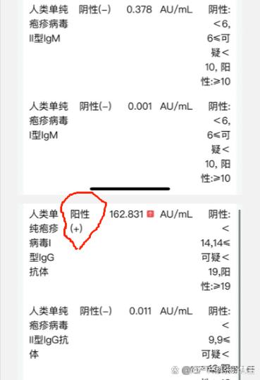 hsv病毒怎么检测图标