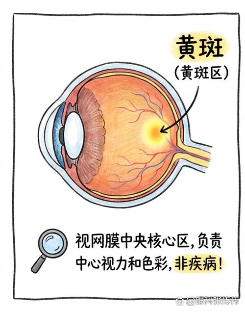 屏幕黄斑怎么消除图标