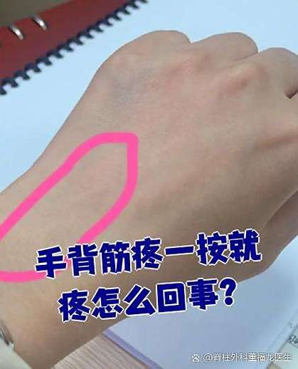 右手手背痛要当心了图标
