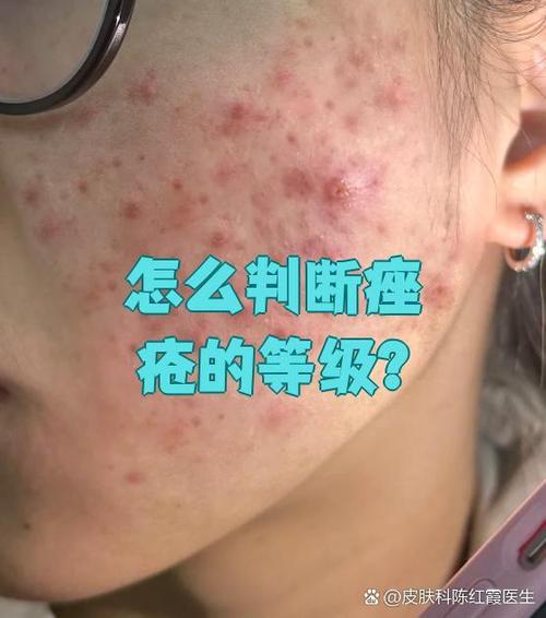 怎么看别人有什么皮肤