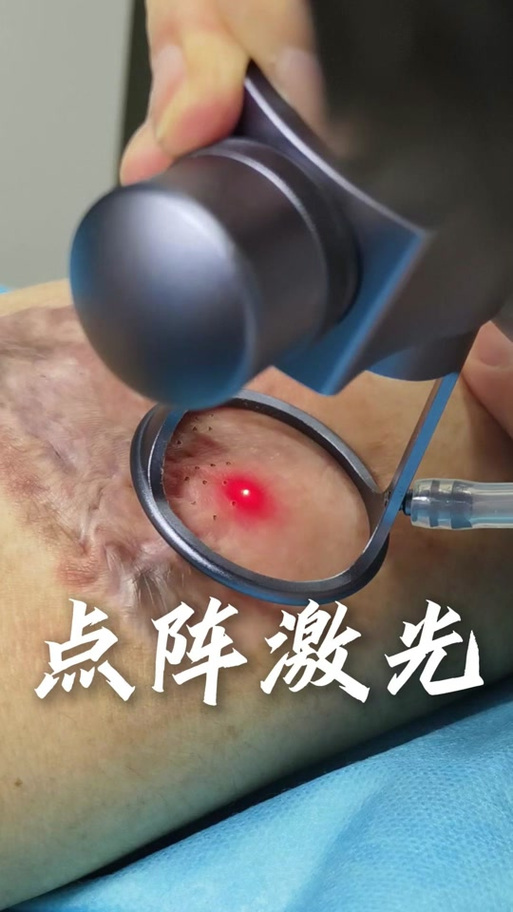 激光的危害有多大图标