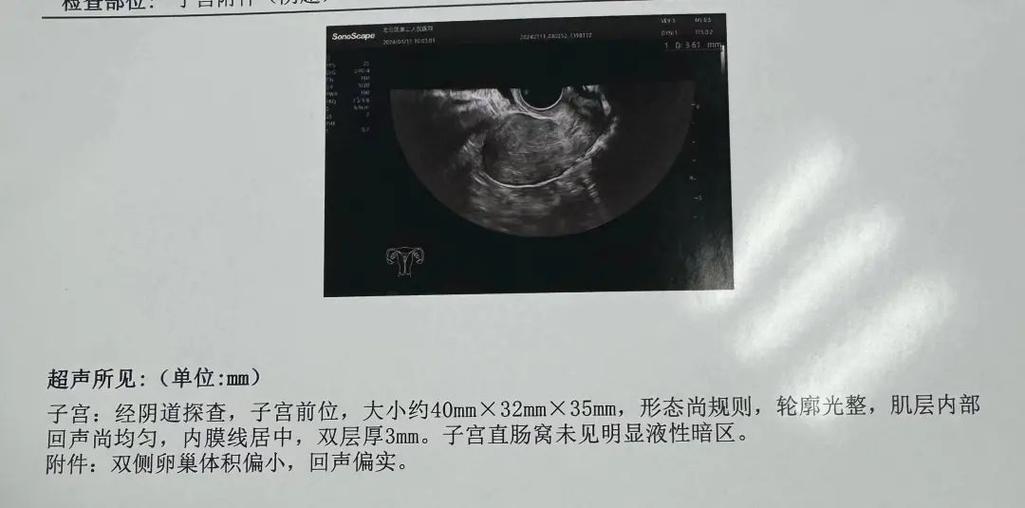 b超有小暗区是什么意思图标