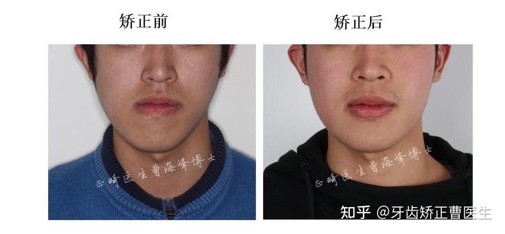 脸有点歪怎么办图标