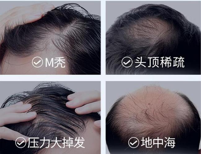 生发的最好方法截图