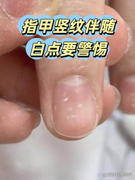 身体出现小白圆点是怎么回事图标