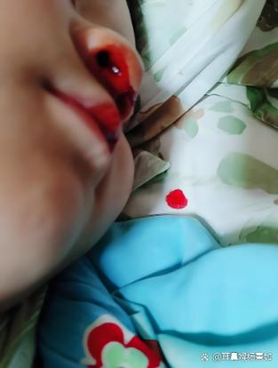 小孩子睡觉莫名流鼻血图标