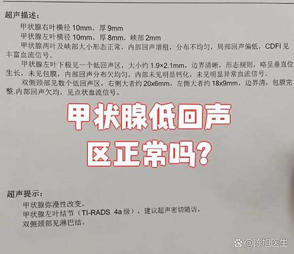 回声减低区和低回声截图