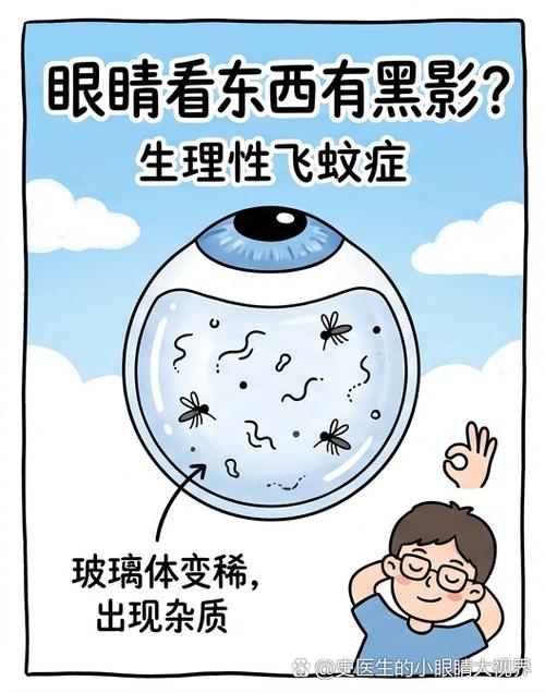 看东西有黑影是怎么回事截图