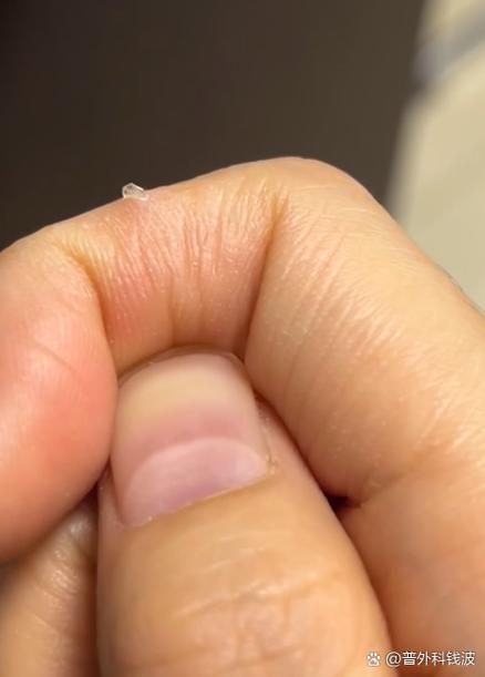 玻璃扎进肉里有危险吗图标