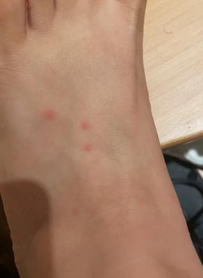 怎么让不怕脚痒的人怕痒图标