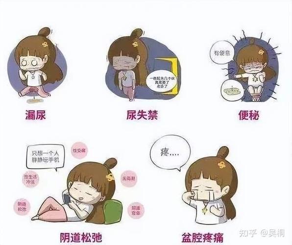盆底肌松弛有什么症状图标