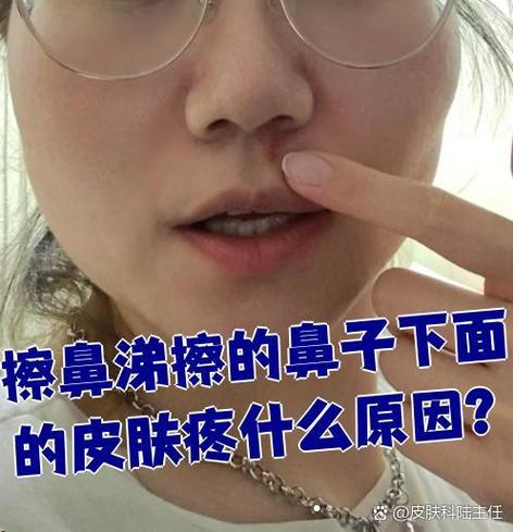 鼻子下面一滴是什么表情截图