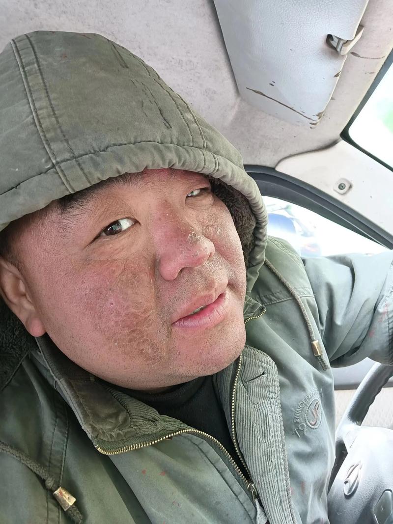 想把特效焊脸上的说说图标