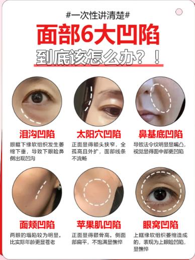 脸部凹陷怎么自己恢复截图