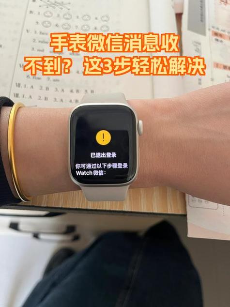 苹果手表怎么收不到微信消息图标