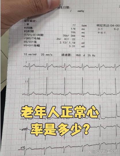 心率过缓一般寿命多久截图