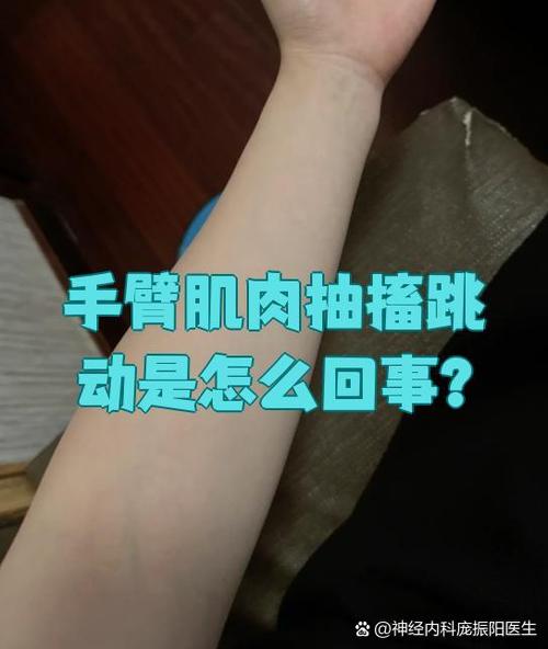 右手臂肌肉间歇性跳动